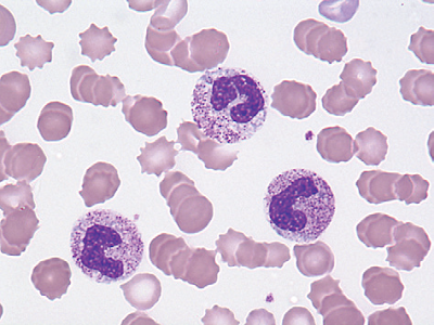 VETERINARY HEMATOLOGY DEXTERVET: band neutrophil with toxic granulation