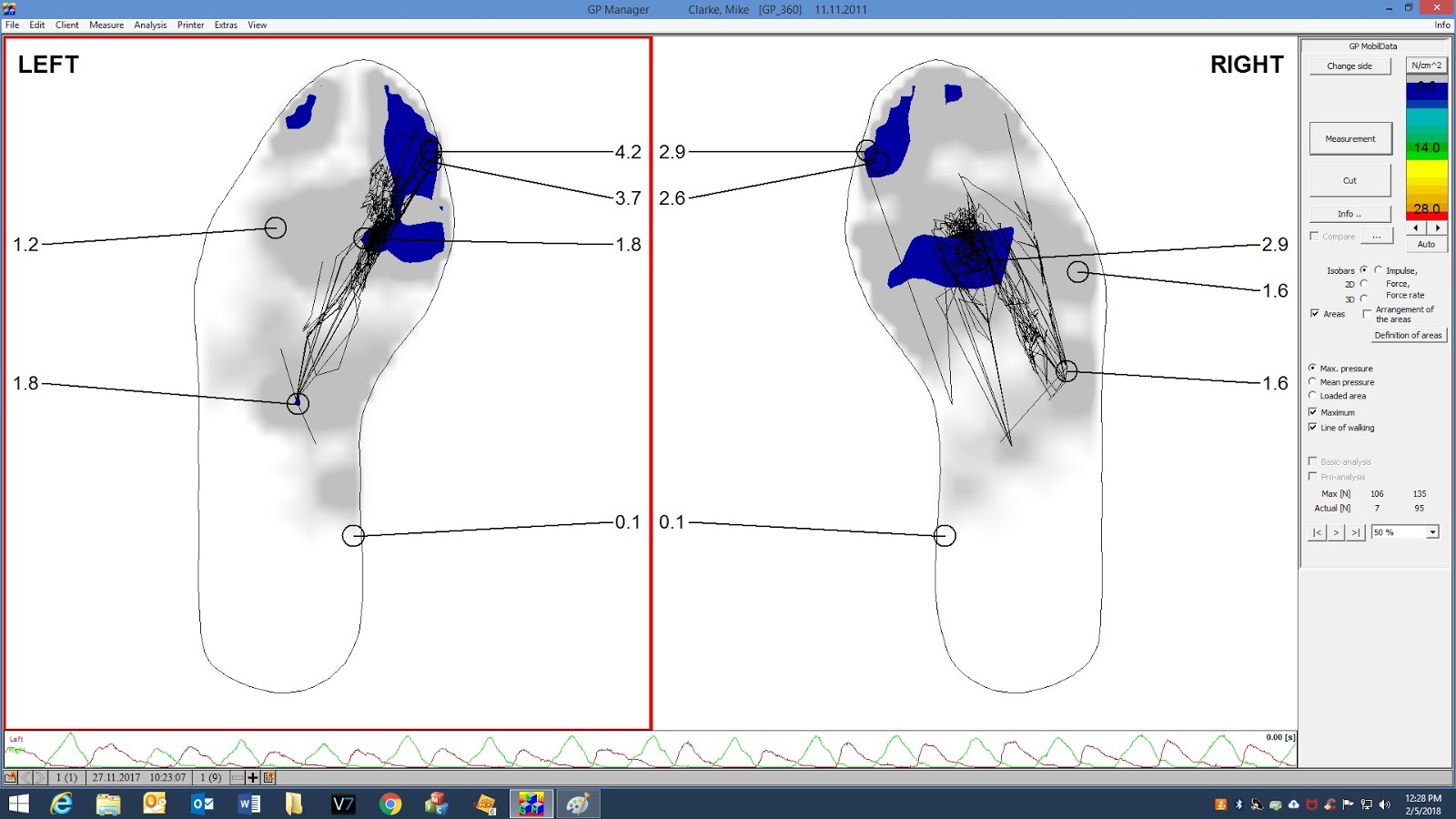 Revolutions In Fitness: Power to the Pedals: Using Foot Pressure ...