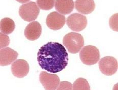 Atlas de Hematologia: Basófilo