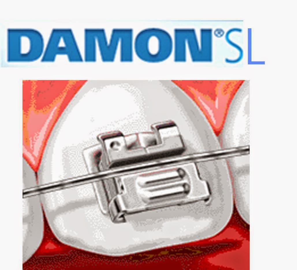 ORTOCEL: Evolución del bracket DAMON.