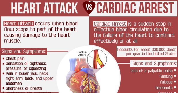 Dr Han Naung @ Henry Han : Electrophysiology and Heart Rhythm : Cardiac ...