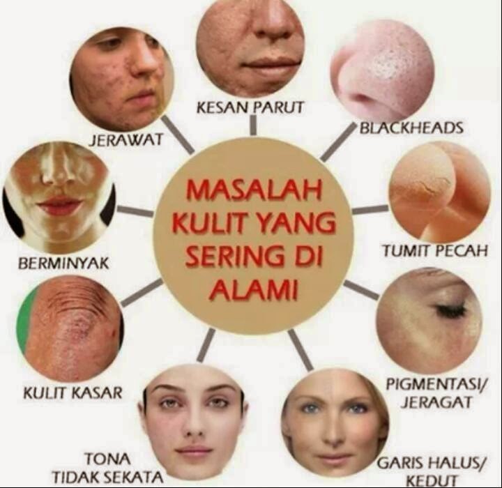 MERAWAT MASALAH KULIT DARI AKAR DENGAN GLUTACAPS WHITEBOSS