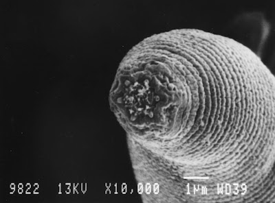 bensozia: Halicephalobus mephisto