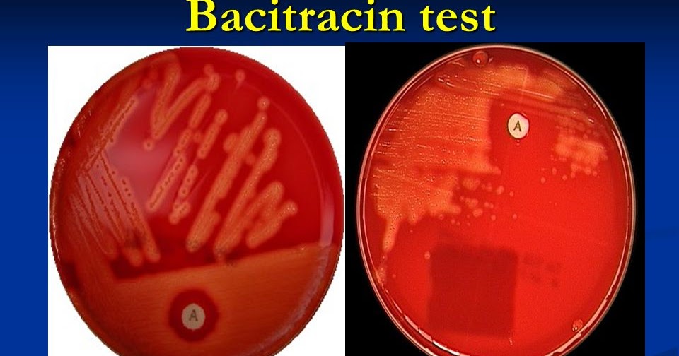 Basitracin Testi (Bacitracin Test) - Microbiology Laboratory Turkey