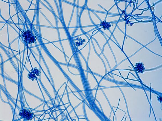 Fun With Microbiology (What's Buggin' You?): Beauveria species