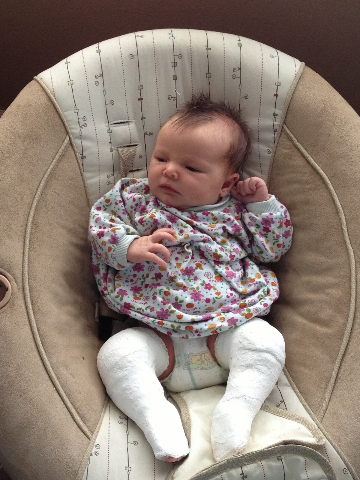 Two cute little feet: First Set Of Casts