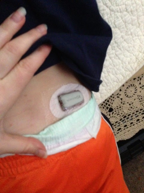 Baby to Bee: The CGM: Insertion Change
