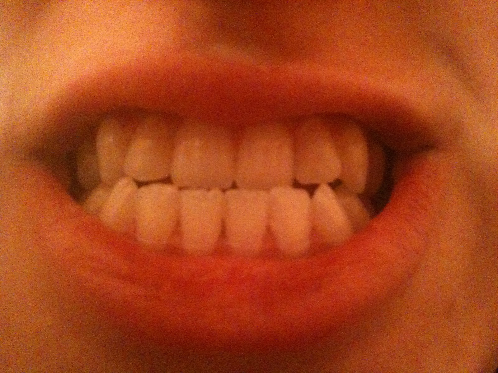 To Blowfish and Beyond!: Before Photos!