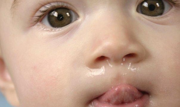 Kenapa Hidung Terus Mengeluarkan Ingus - Hari Hari Sehat Bersama