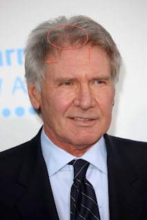 Celebrity Hair Loss: Harrison Ford's Hair Loss