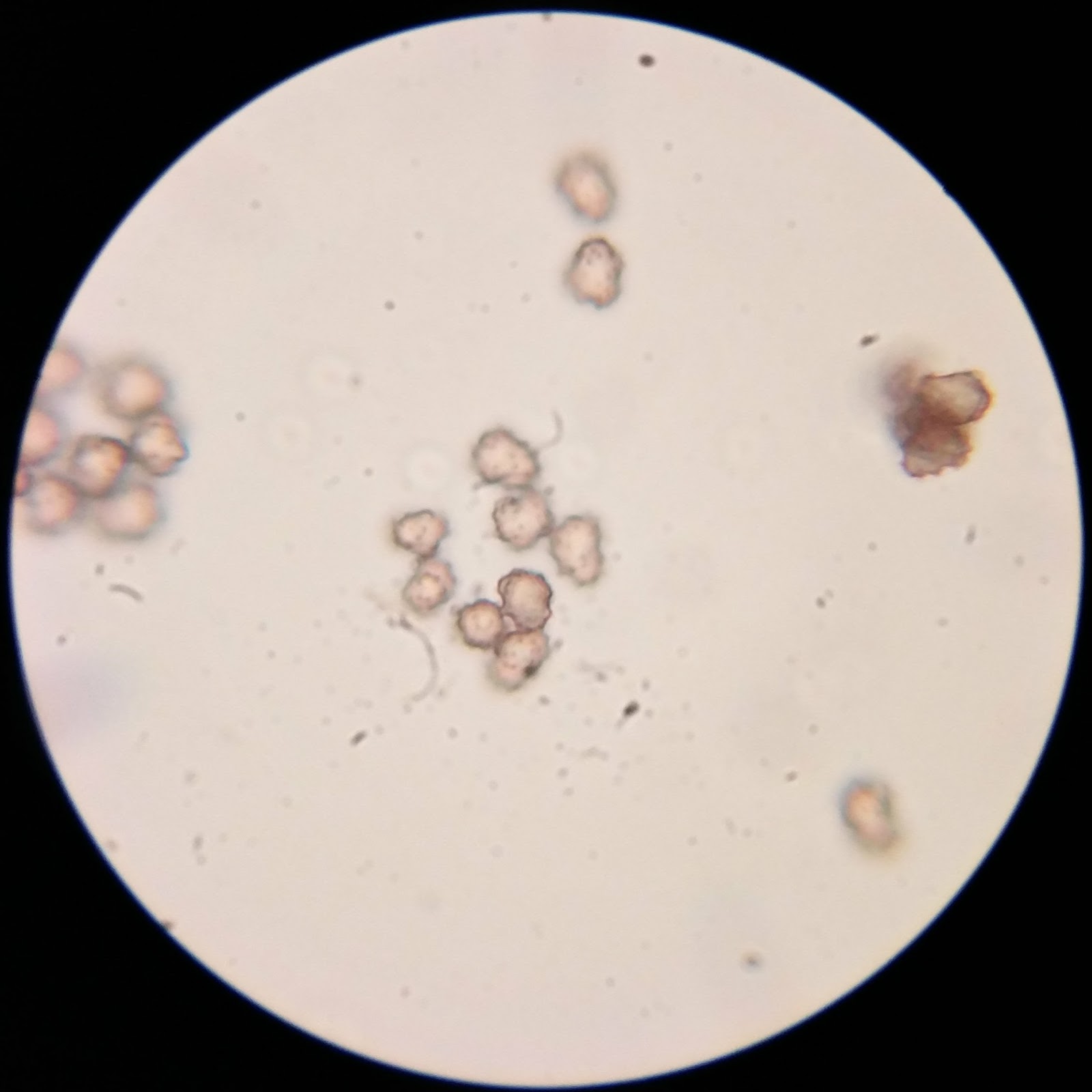 Misidentifying Fungi: Graffham Common Fungus Walk