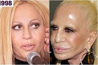 TOP 10: LAS CIRUGÍAS MAS FEAS DEL MUNDO | Lo mejor de lo mejor