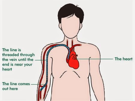 Ask the Nurse Practitioner