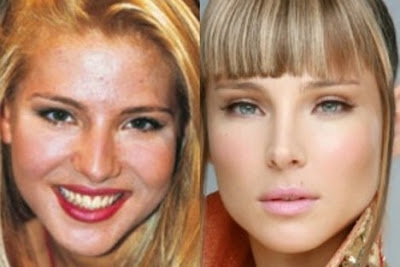 Elsa Pataky, antes y después de la cirugía. | POR EL AMOR DE KUBRICK