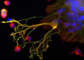 Le Cerveau de l'Enfant et de l'Adolescent: Substance Blanche et ...