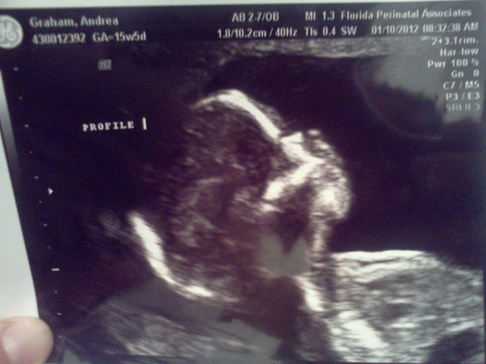 Our Journey With Baby: Ultrasounds