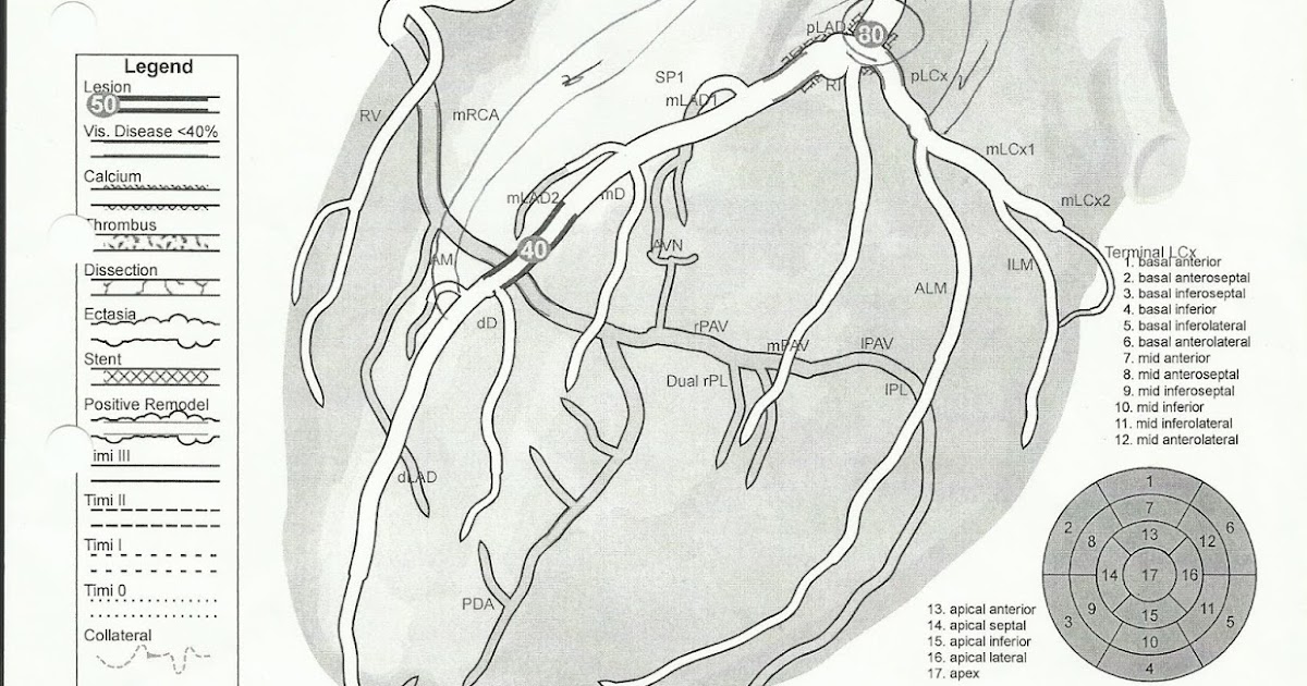 Kirby's Travels: Angiogram diagram report