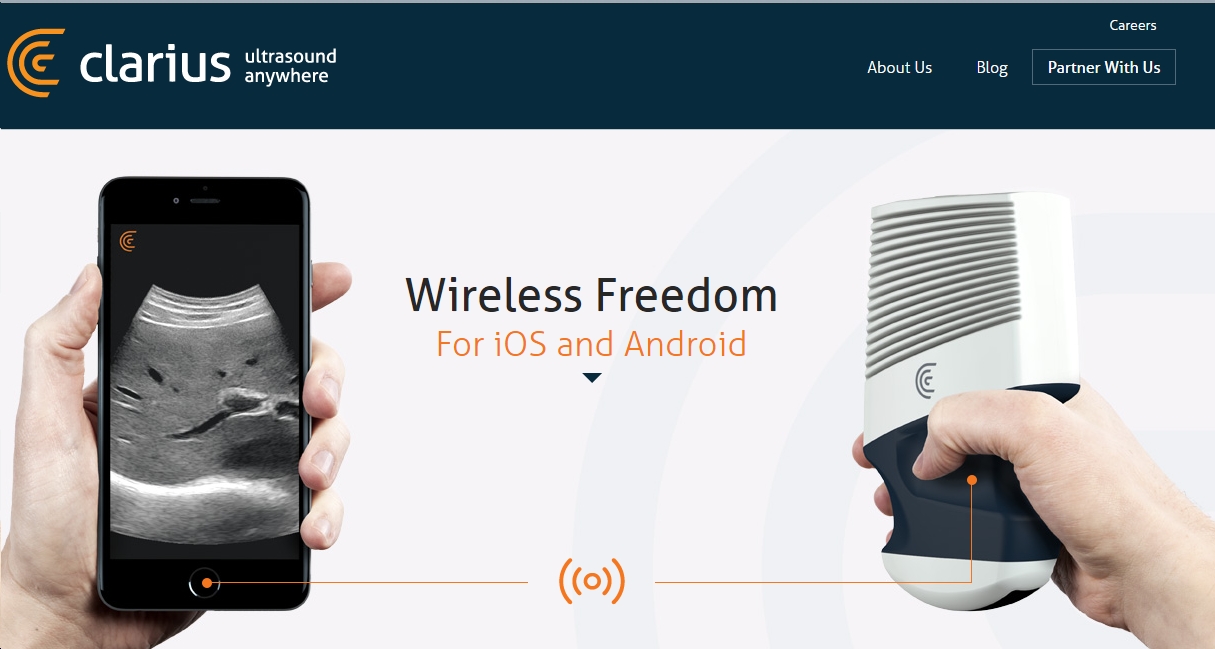 Tecnologia da Informação e a Medicina: Clarius: ultrassom portátil ...