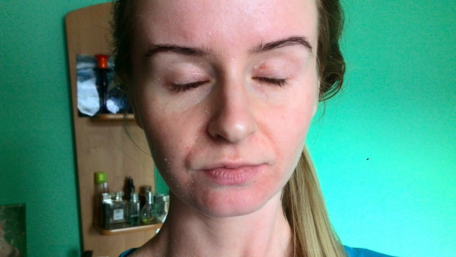 Lejdis - Kosmetologia Estetyczna: ATREDERM - efekty, zdjęcia ...