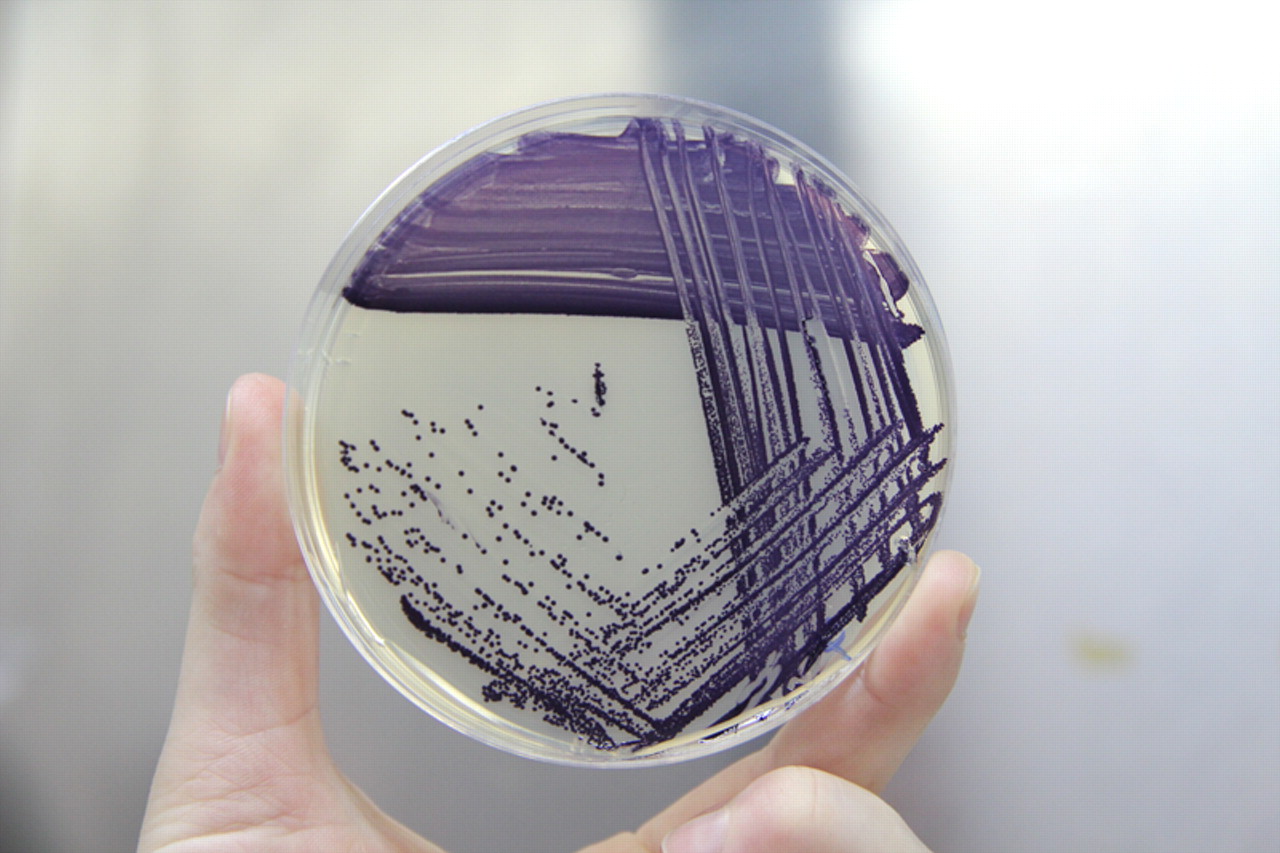 Re-citing Research: Colors Galore: Microbial pigments and virulence