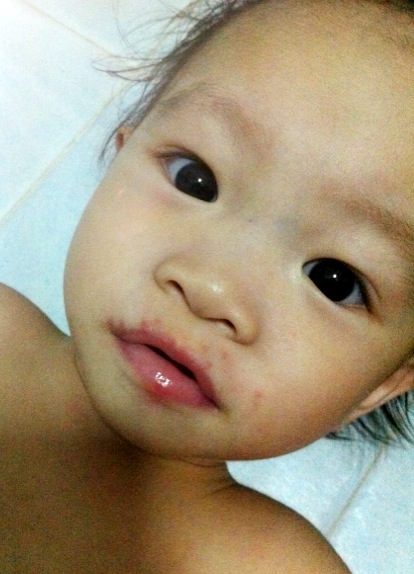 Mei Mei sensitive skin again