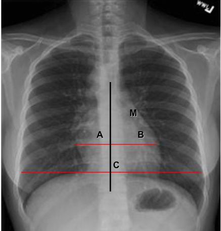 Rumus Cr Cara Mudah Menghitung Ctr Dan Konversi - Riset