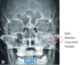 DICAS DE RADIOLOGIA - Tudo Sobre Radiologia: IMAGENS RADIOLÓGICAS ...