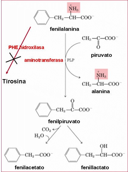 Bioquímica da Nutrição: Fenilcetonúria