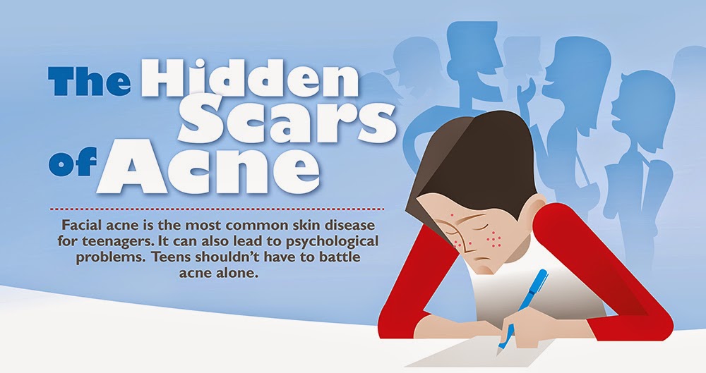 The Phenomenal Mama: Safeguard Derma Sense: #FaceUp to Acne