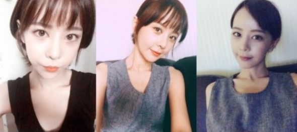 Plastic Surgery in Korea : Hyerin’s Plastic Surgery Real Review