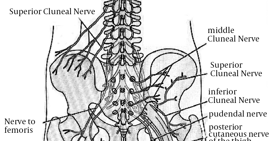 Superior Cluneal Nerve Block For Treatment Of Buttock