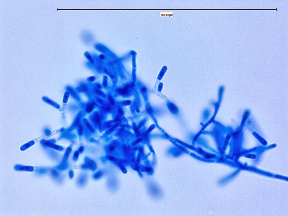 Fun With Microbiology (What's Buggin' You?): Trichophyton terrestre