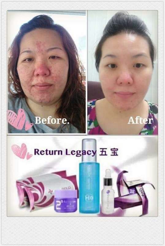Malaysia Return Legacy Products(reviewed/explained)- Redoxy, Medigold ...