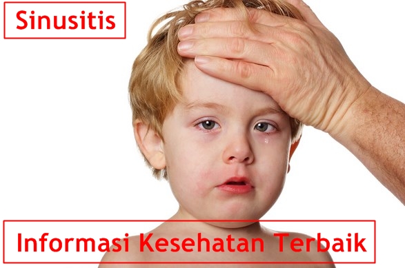11 Gejala dan Penyebab Penyakit Sinusitis - Info Kesehatan Terbaik
