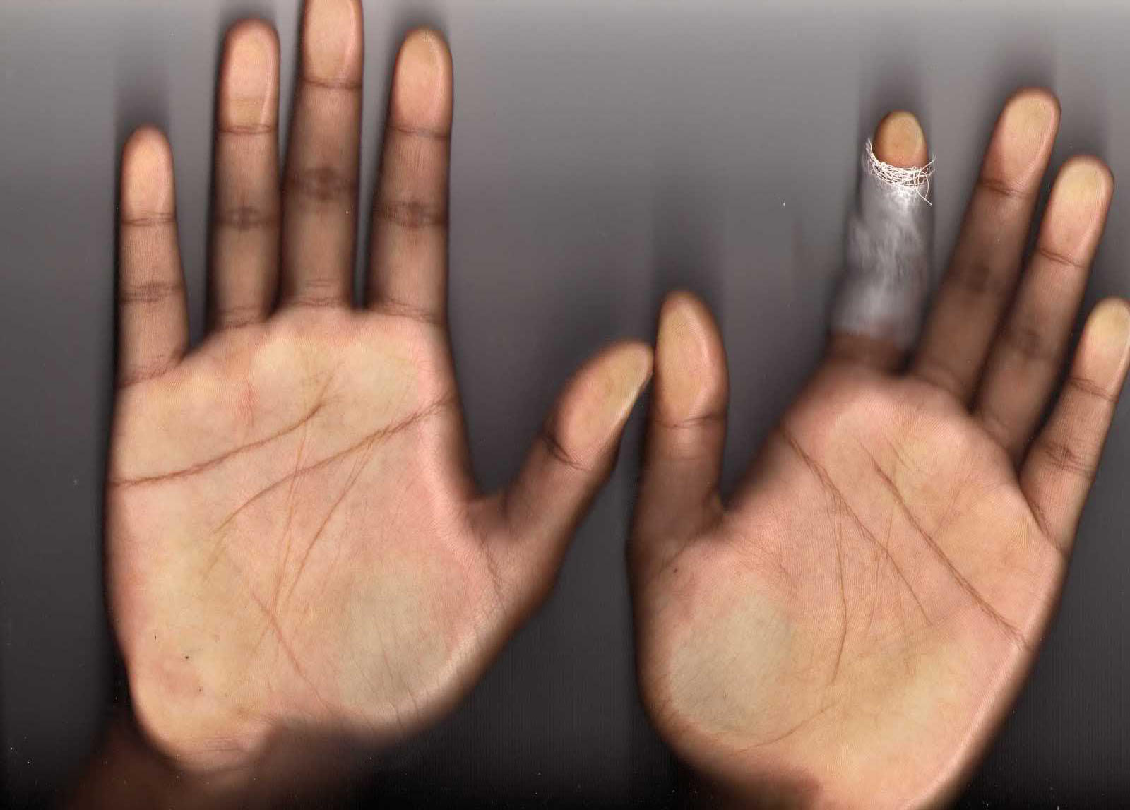 Island On Fate Line & Broken Fate Line Palmistry ~ INDIAN PALM READING ...