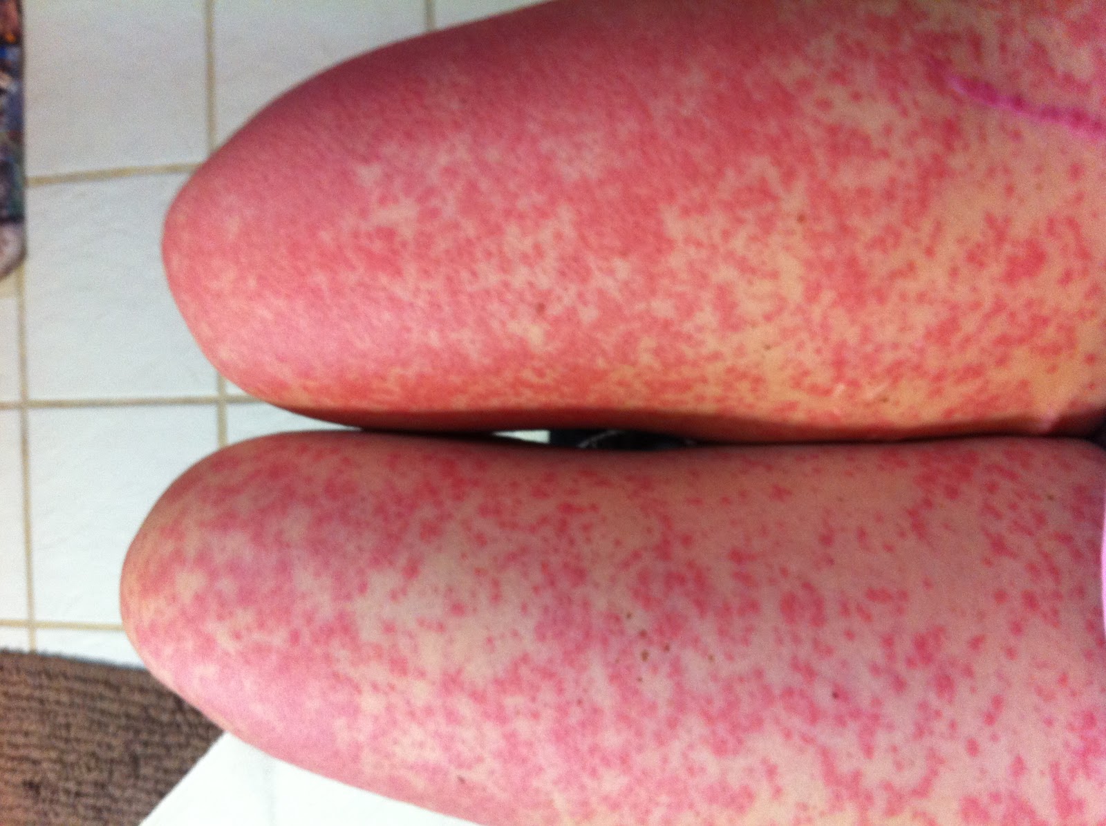 Prayers for Jen: Don't worry, this drug has very little side effects ...