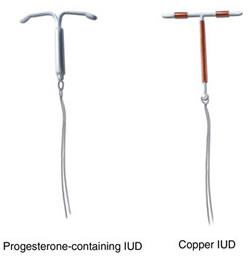 Writings in Pink: IUD's for Teen Girls?