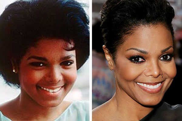 Janet Jackson Plastic Surgery