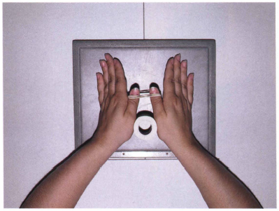 PA STRESS "SKIER'S THUMB" PROJECTION - RadTechOnDuty