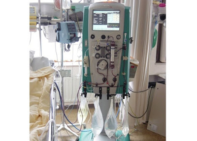 Healthcare Industry Insights: CRRT to Relieve Patients with Acute ...