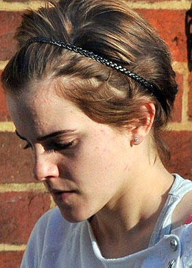 Emma Watson Without makeup Photo ~ smashgossips