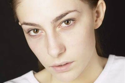 Los 10 Síntomas que advierten sobre la carencia de vitaminas (2da Parte)