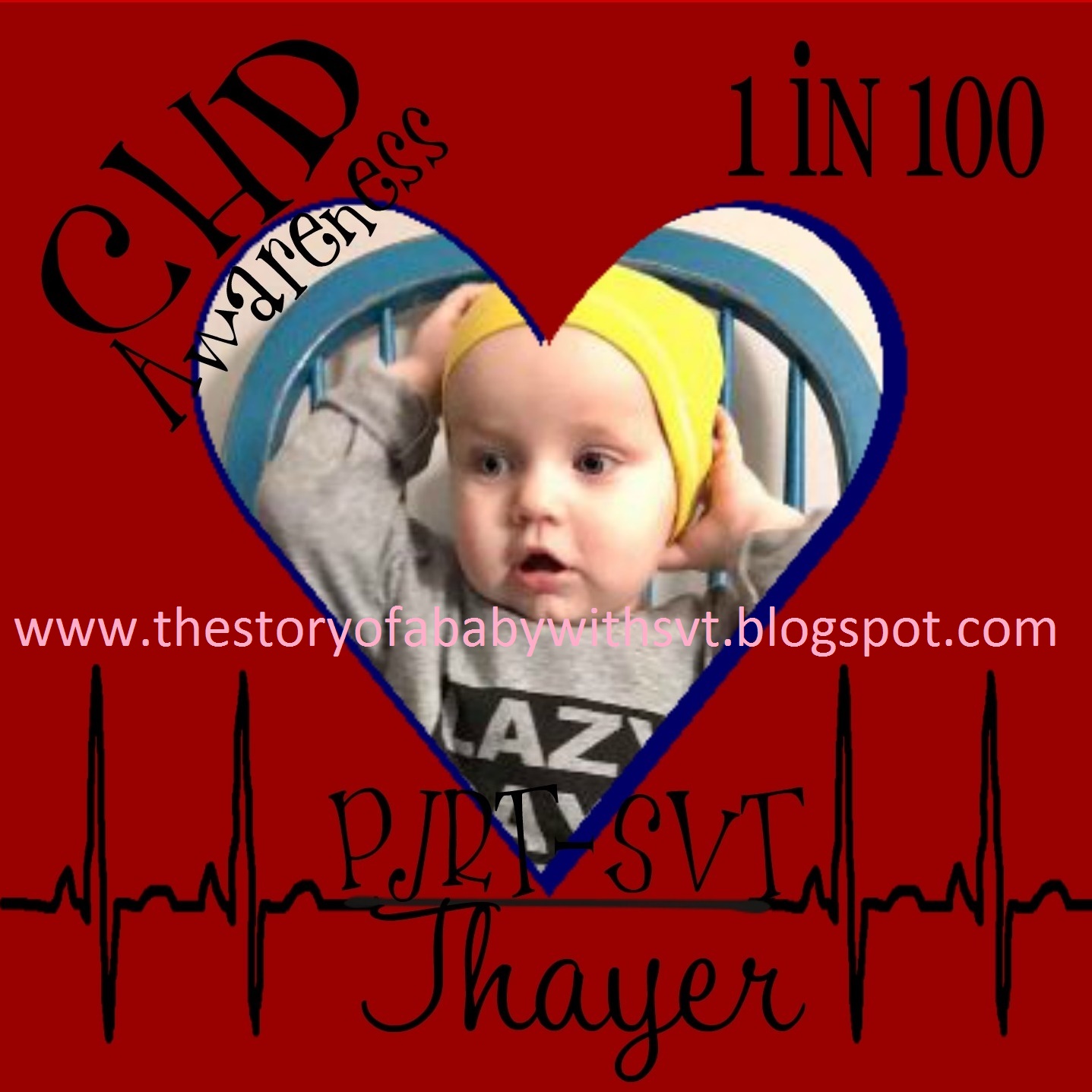 The Story of a Baby with SVT(PJRT): My PJRT Sisters and Brothers