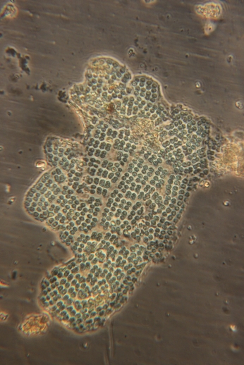 Microscopy Musings: Merismopedia