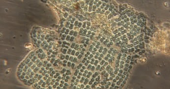 Microscopy Musings: Merismopedia