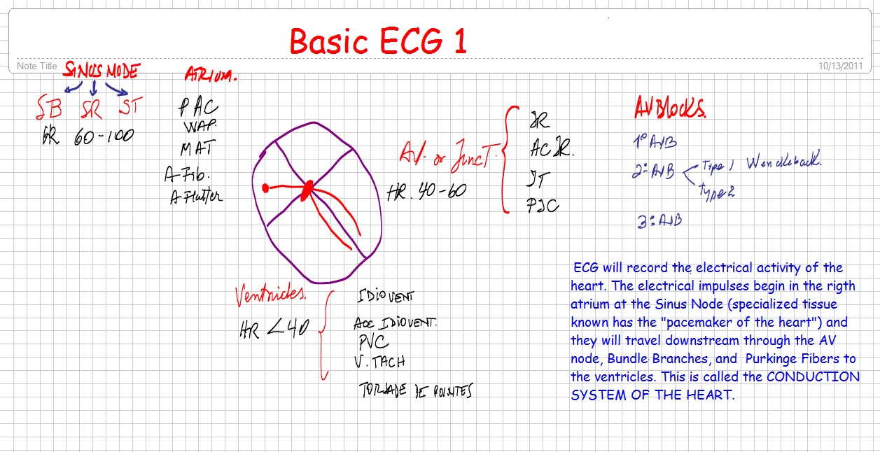 Quike & Vivi's World: Basic ECG concepts...(Arrhythmias Big picture)