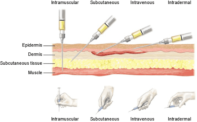 Rehab 2018 | SubCut training Subcutaneous injection
