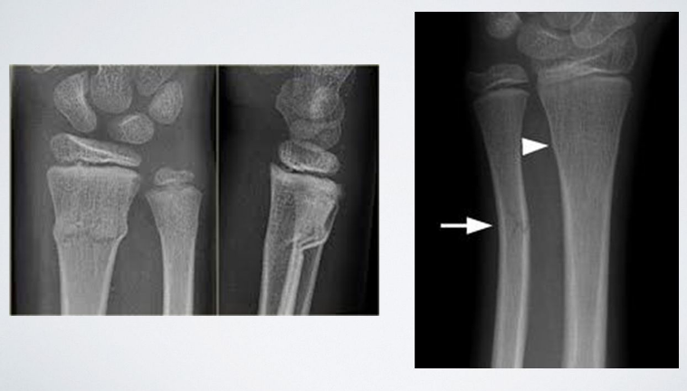 Procedimiento de atención al lesionado de la empresa INDUSTRIA DE ...