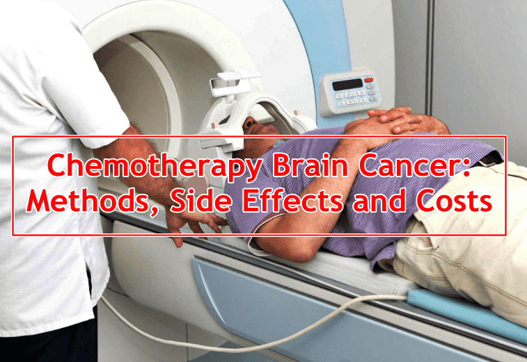 Chemotherapy Brain Cancer: Methods, Side Effects and Costs - Asbestos