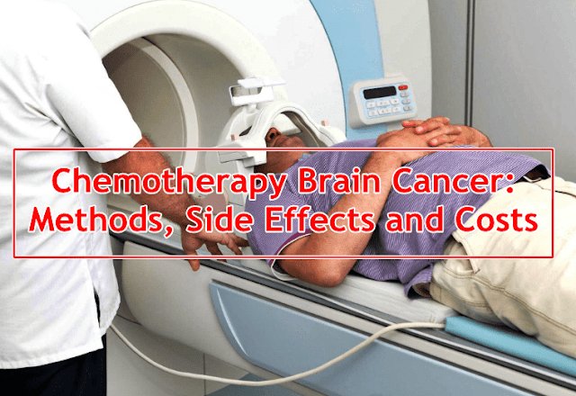 Chemotherapy Brain Cancer: Methods, Side Effects and Costs - Asbestos